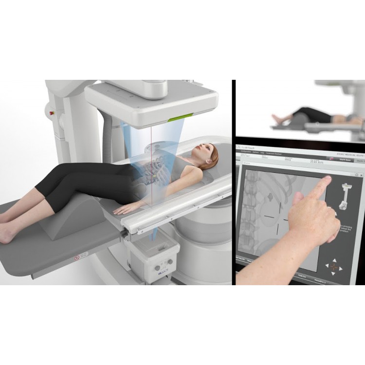 Литотриптер MODULITH SLX-F2 "connect" купить в Москве | компания ...